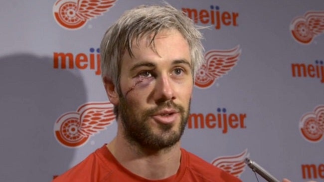Red Wings Drew Miller Feared He Lost an Eye, but Doesn’t Want to Miss a ...