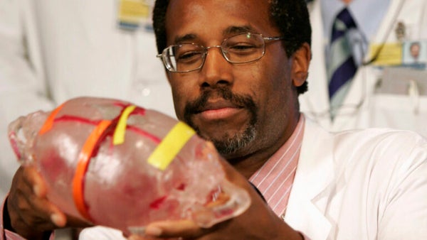 Report sheds light on other side of Ben Carson’s conjoined twins surgeries