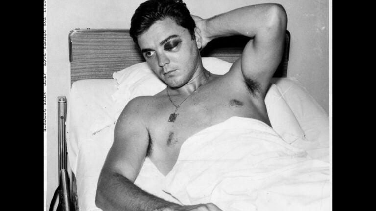 Shock, then resolve for ’67 Red Sox after Tony Conigliaro beaned