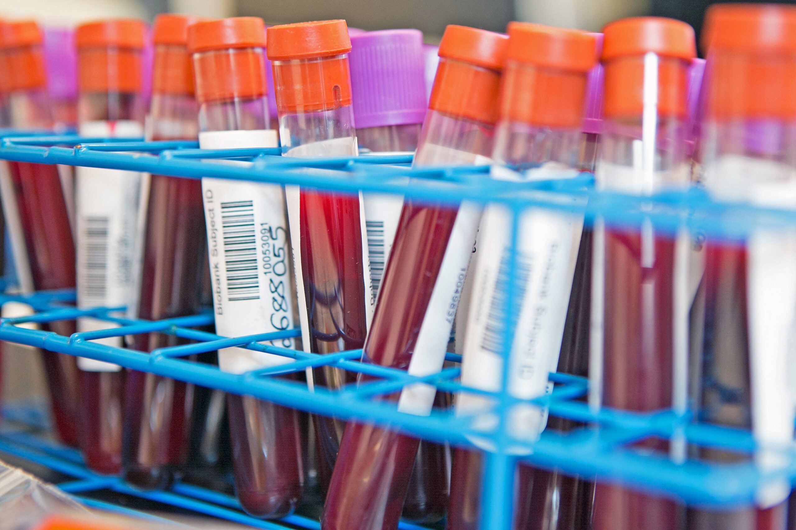 High school students began talking about blood. One fainted. Then ...