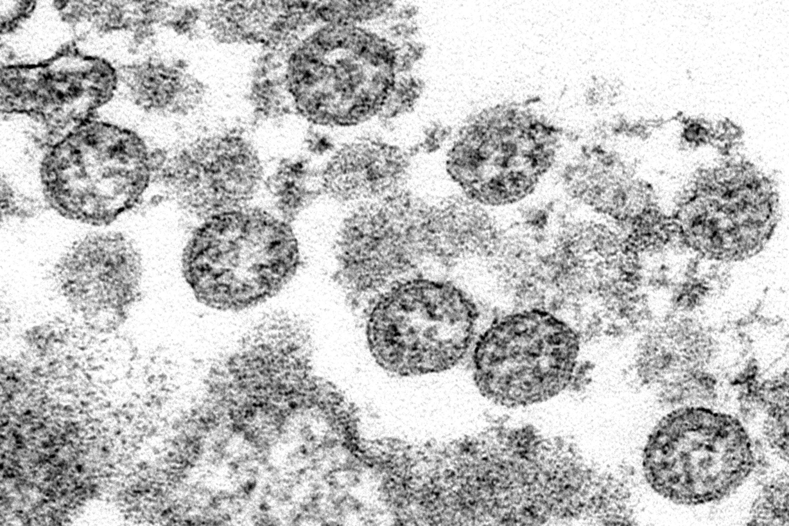 More Evidence Suggests COVID 19 Was In US By Christmas 2019 more-evidence-suggests-covid-19-was-in-us-by-christmas-2019