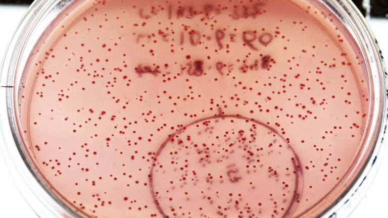 E Coli Found In Mansfield Drinking Water Residents Told To Boil Water