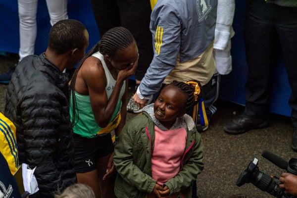 Mysterious sunflower syndrome is spotlighted at MGH