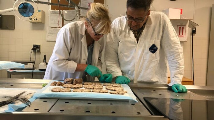 New BU research could help experts diagnose CTE before death