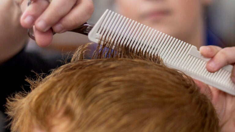 Cutting edge hair loss treatment is a '90s repurposed drug