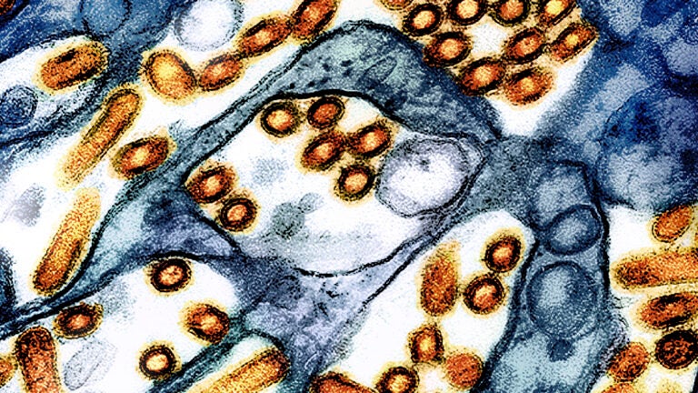 Beware the birds: Bird flu confirmed in Boston