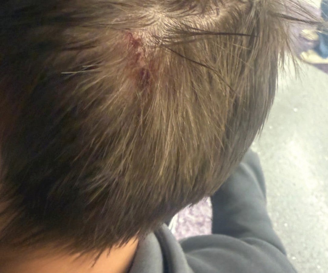 Indian national indicted in fork-stabbing incident that diverted plane ...